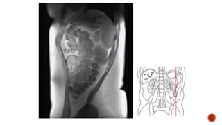 Pelvis cross section anatomy | PPTX