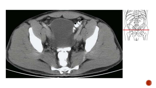 Pelvis cross section anatomy