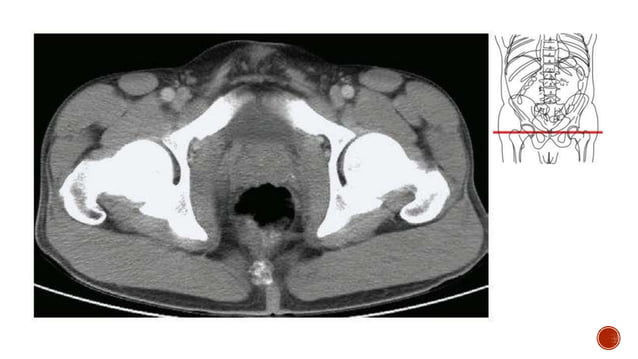 Pelvis cross section anatomy