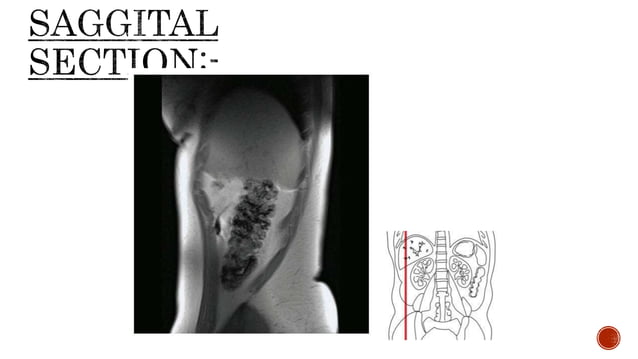 Pelvis cross section anatomy
