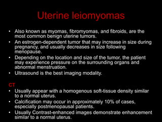 Pelvis ct pathology | PPTX