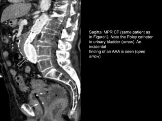 Pelvis ct pathology | PPT