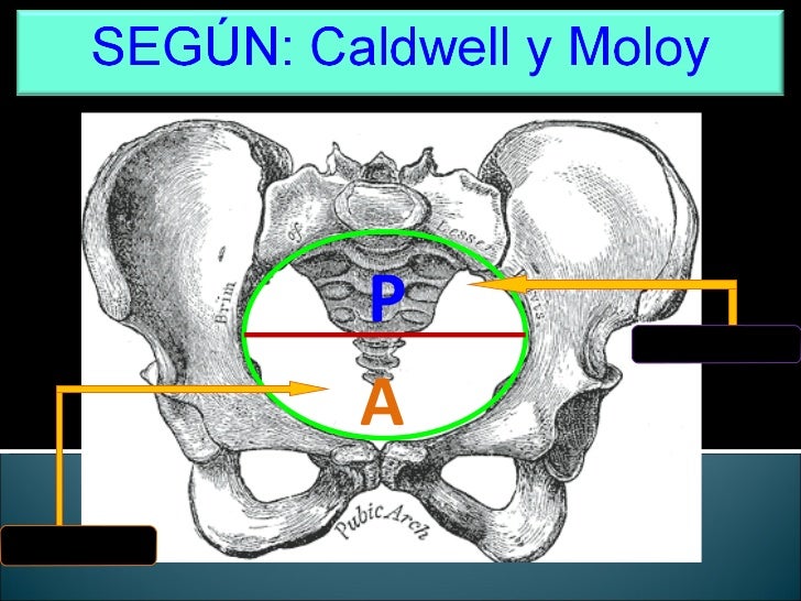 Pelvis femenina obe i