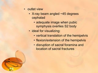 Pelvis fractures | PPTX