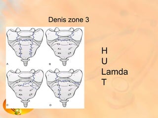 Pelvis fractures | PPTX