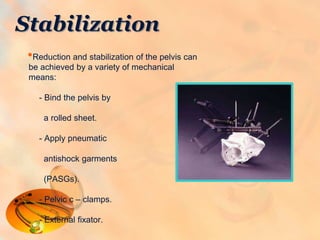 Pelvis fractures | PPTX