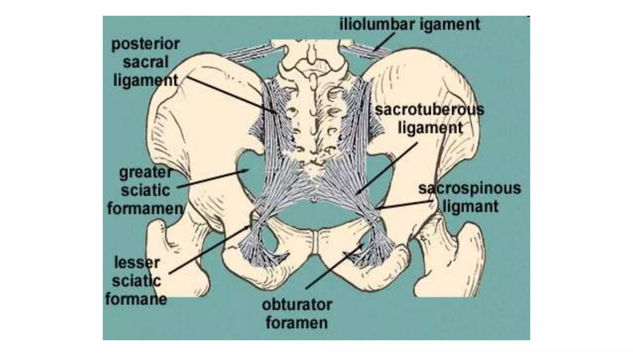 pelvis fractures corrected.pptx