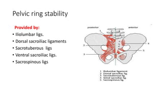 pelvis fractures corrected.pptx