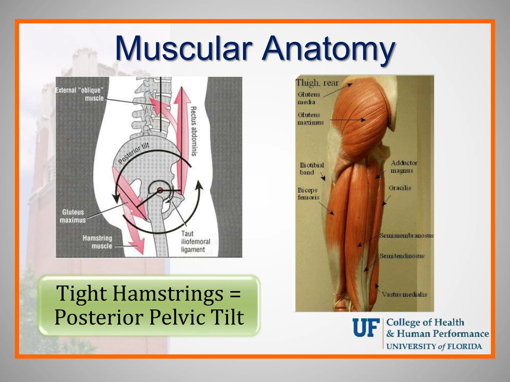 Pelvis, Hip and Thigh Pathologies.pptx