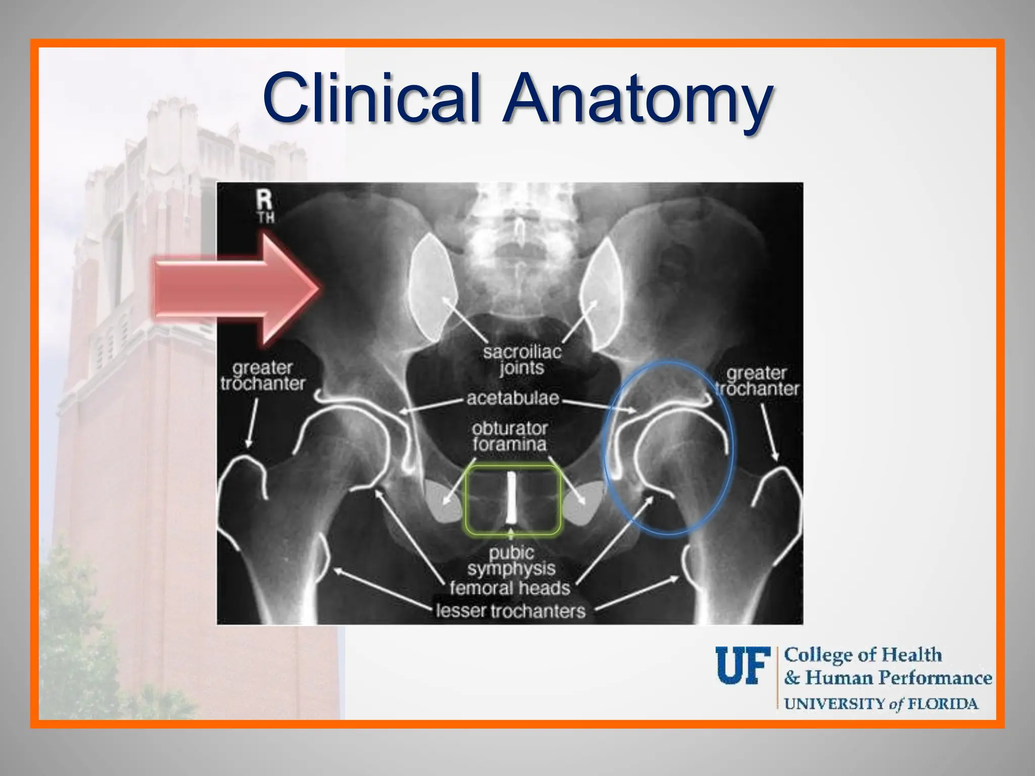 Pelvis, Hip and Thigh Pathologies.pptx