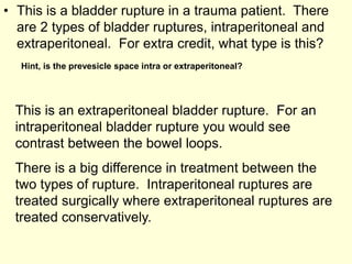 pelvis_fgvvvvgglab_166101_284_6602_v1.ppt