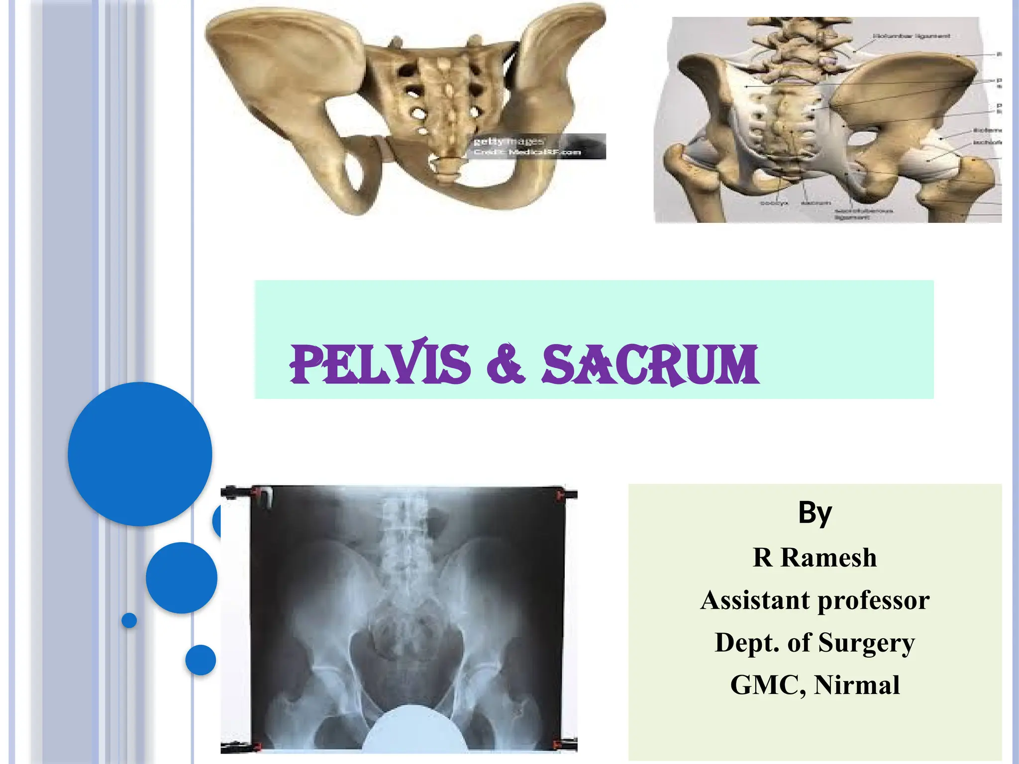 pelvis nd sacrum ppt for theory classes and practical purpose | PPTX