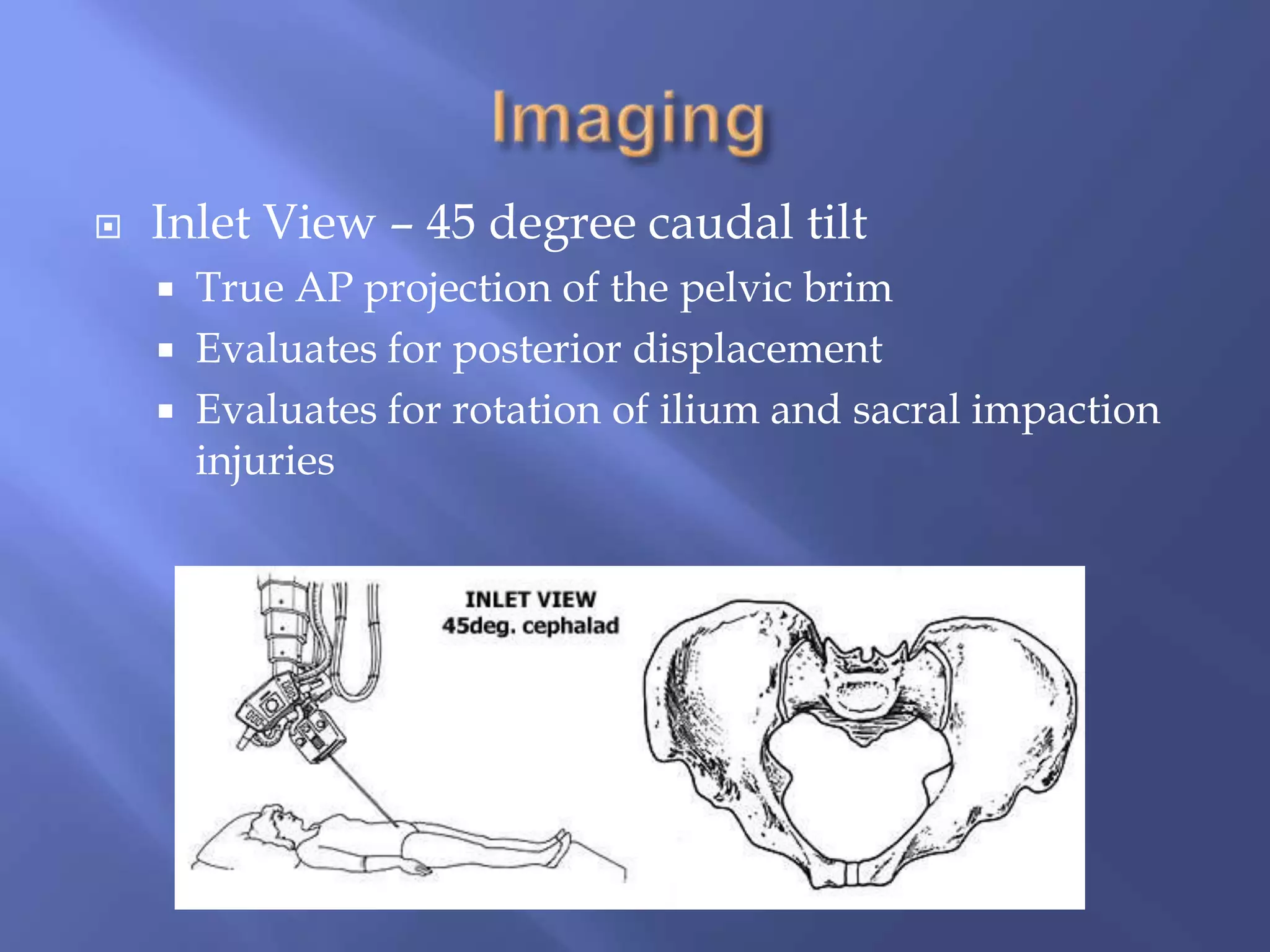 Pelvic fracture | PPTX
