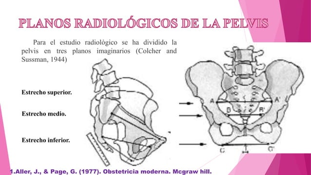 pelvis osea obstetrica