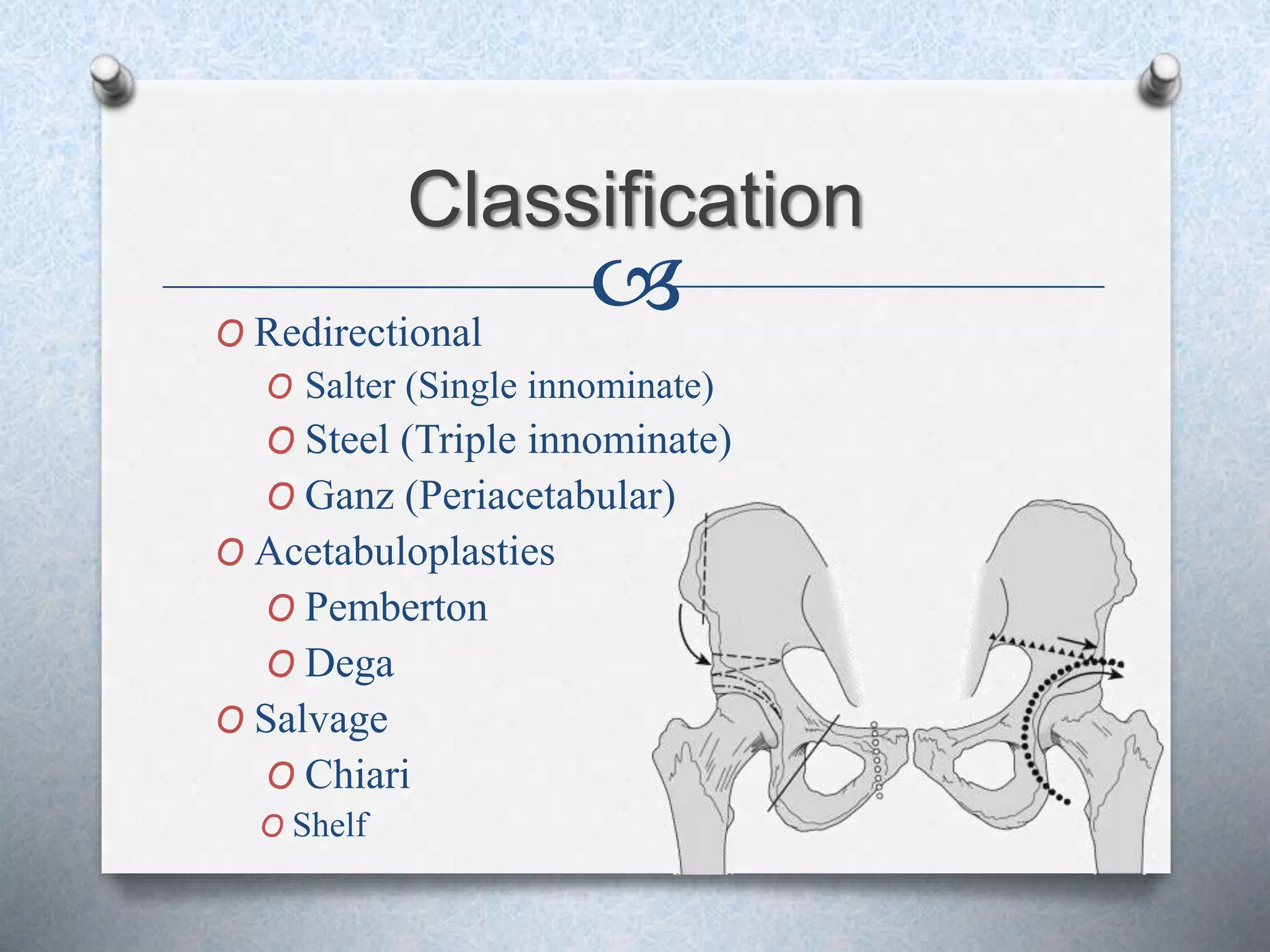 Pelvis osteotomies in ddh patients | PPTX