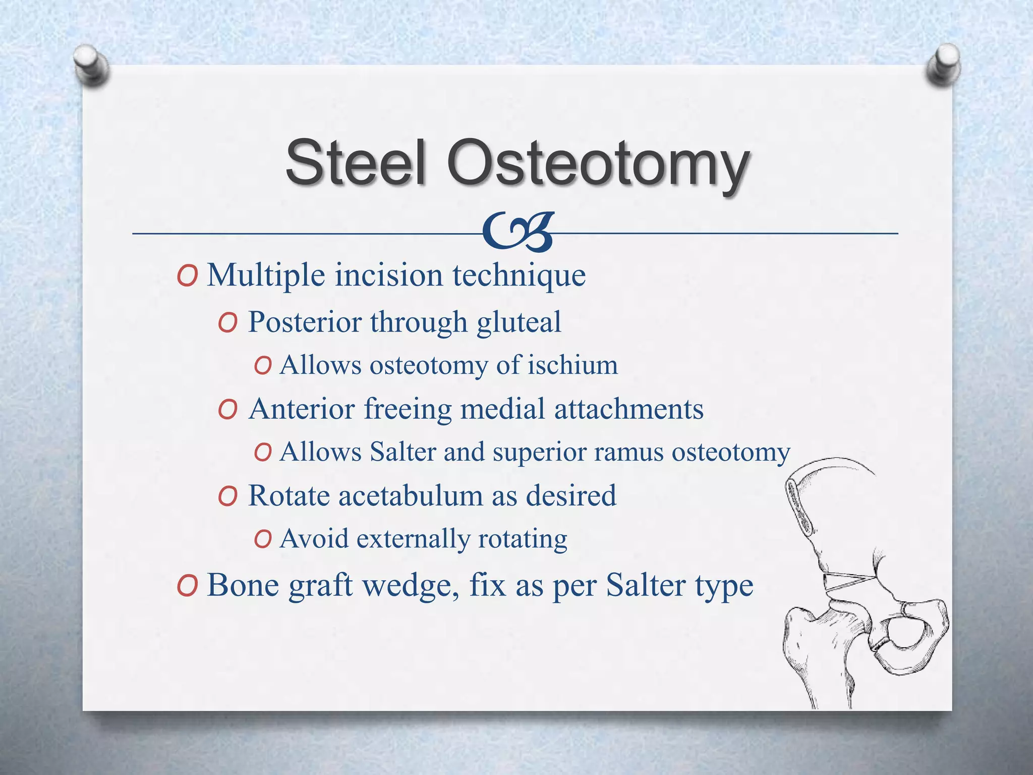 Pelvis osteotomies in ddh patients | PPTX