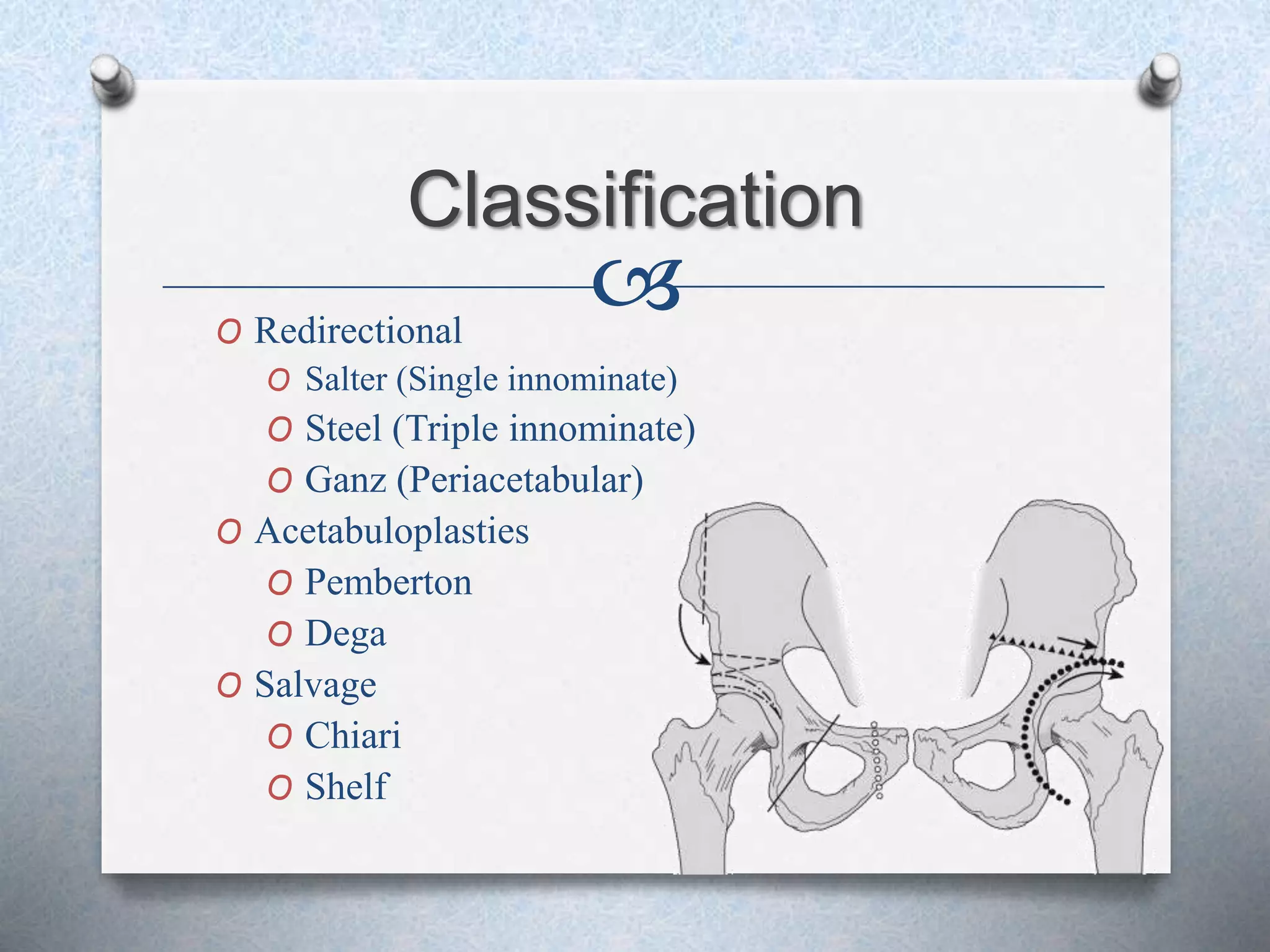 Pelvis osteotomies in ddh patients | PPTX