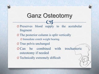 Pelvis osteotomies in ddh patients | PPTX