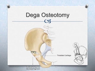 Pelvis osteotomies in ddh patients | PPTX