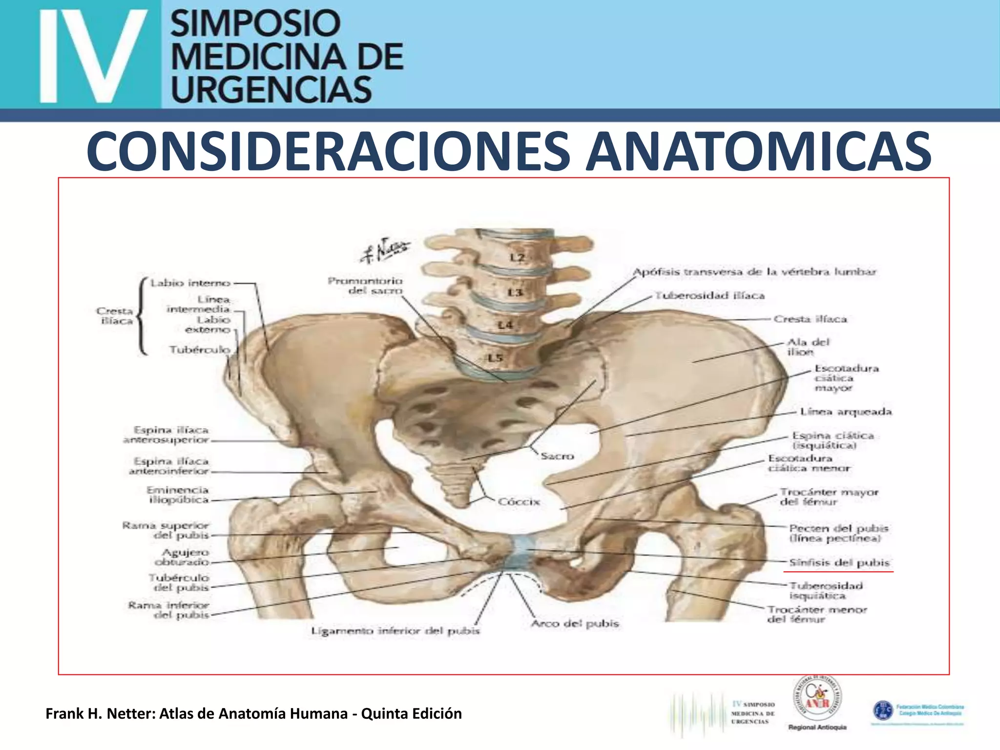TRAUMA DE PELVIS EN PACIENTE HEMODINAMICAMENTE INESTABLE 2016 | PPT