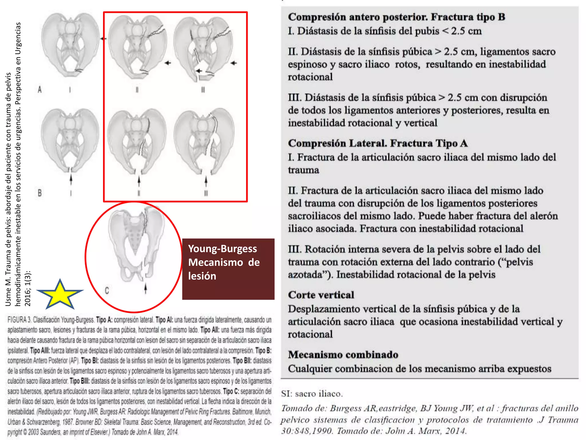 TRAUMA DE PELVIS EN PACIENTE HEMODINAMICAMENTE INESTABLE 2016 | PPTX