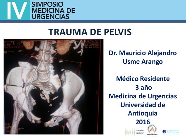 TRAUMA DE PELVIS EN PACIENTE HEMODINAMICAMENTE INESTABLE 2016