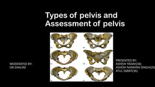 pelvis types (1).pptx[ASHISH) obs seminar | PPT