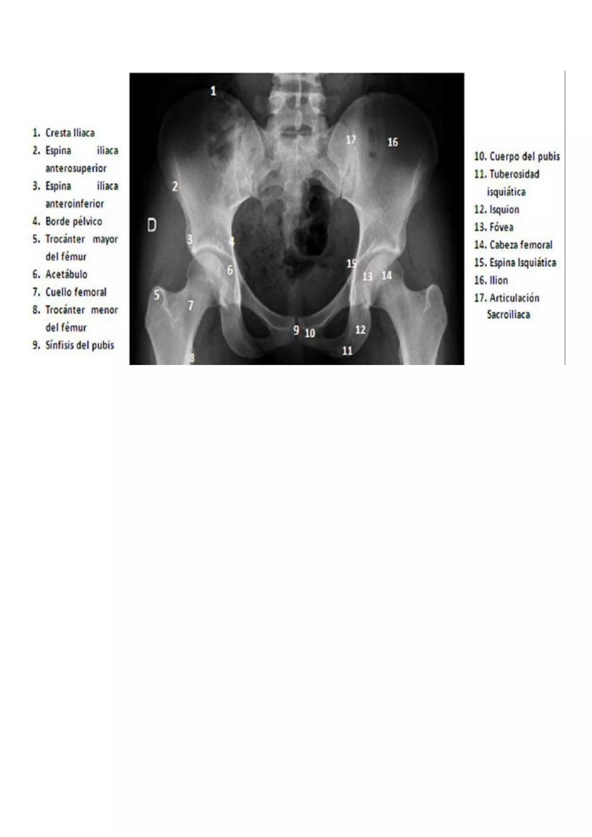 Pelvis y cadera con sus partes señaladas | PDF