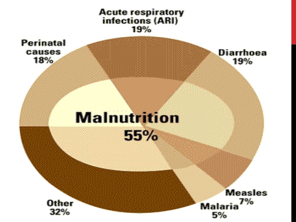 Protein Energy Malnutrition