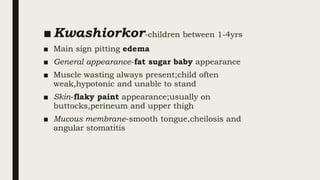 protein energy malnutrition | PPTX