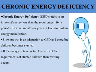 Protein Energy Malnutrition | PPTX