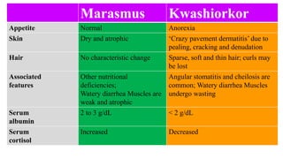 Protein Energy Malnutrition (PEM) | PPTX