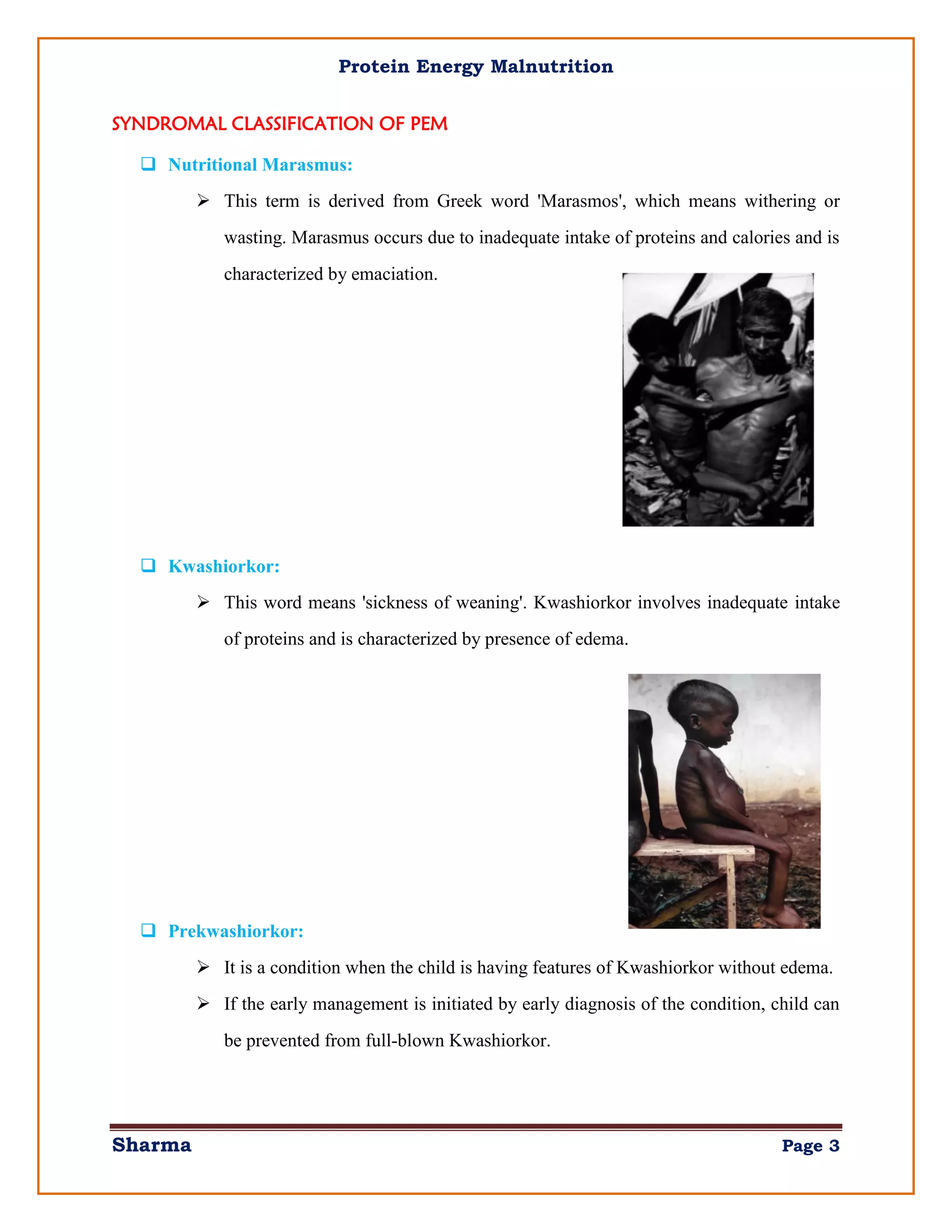 Protein Energy Malnutrition | PDF