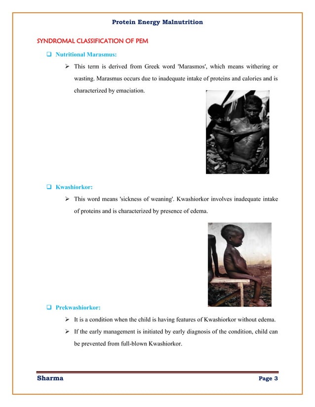 Protein Energy Malnutrition | PDF