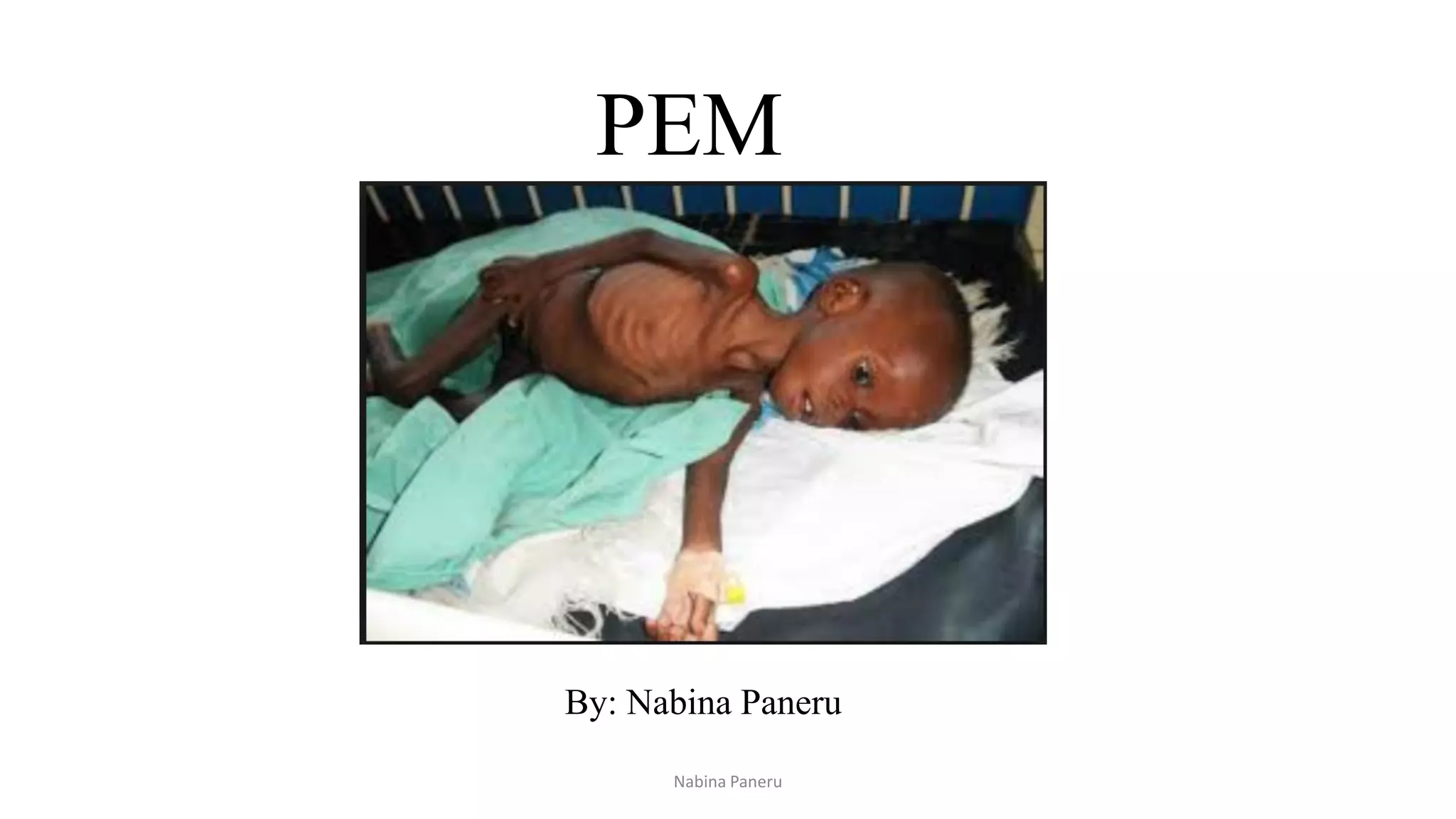 PEM | PDF