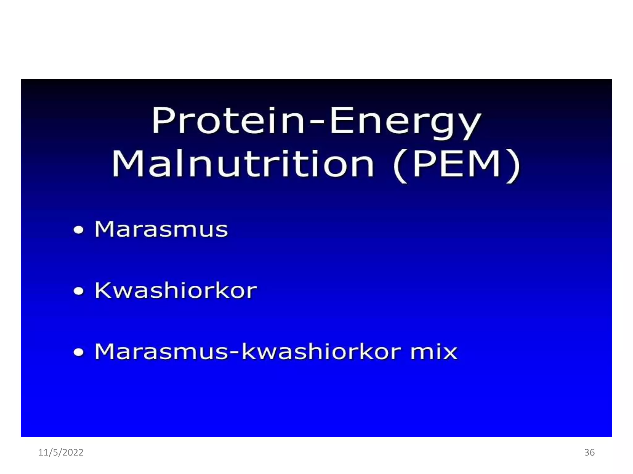 Balanced diet snd PEM management.pptx