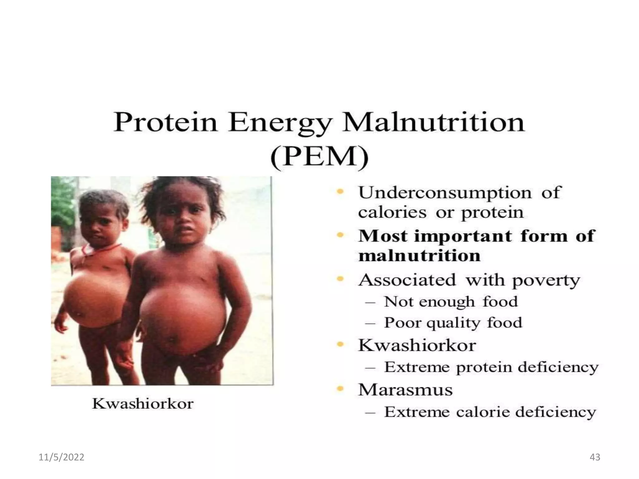 Balanced diet snd PEM management.pptx