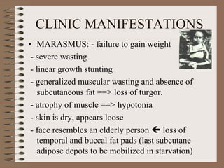 Protein energy Malnutrition | PPT