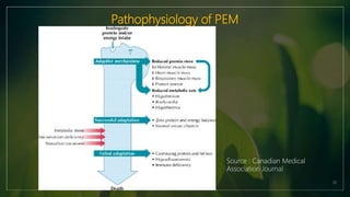 Pem and oral health | PPT