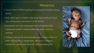 Pem and oral health | PPT