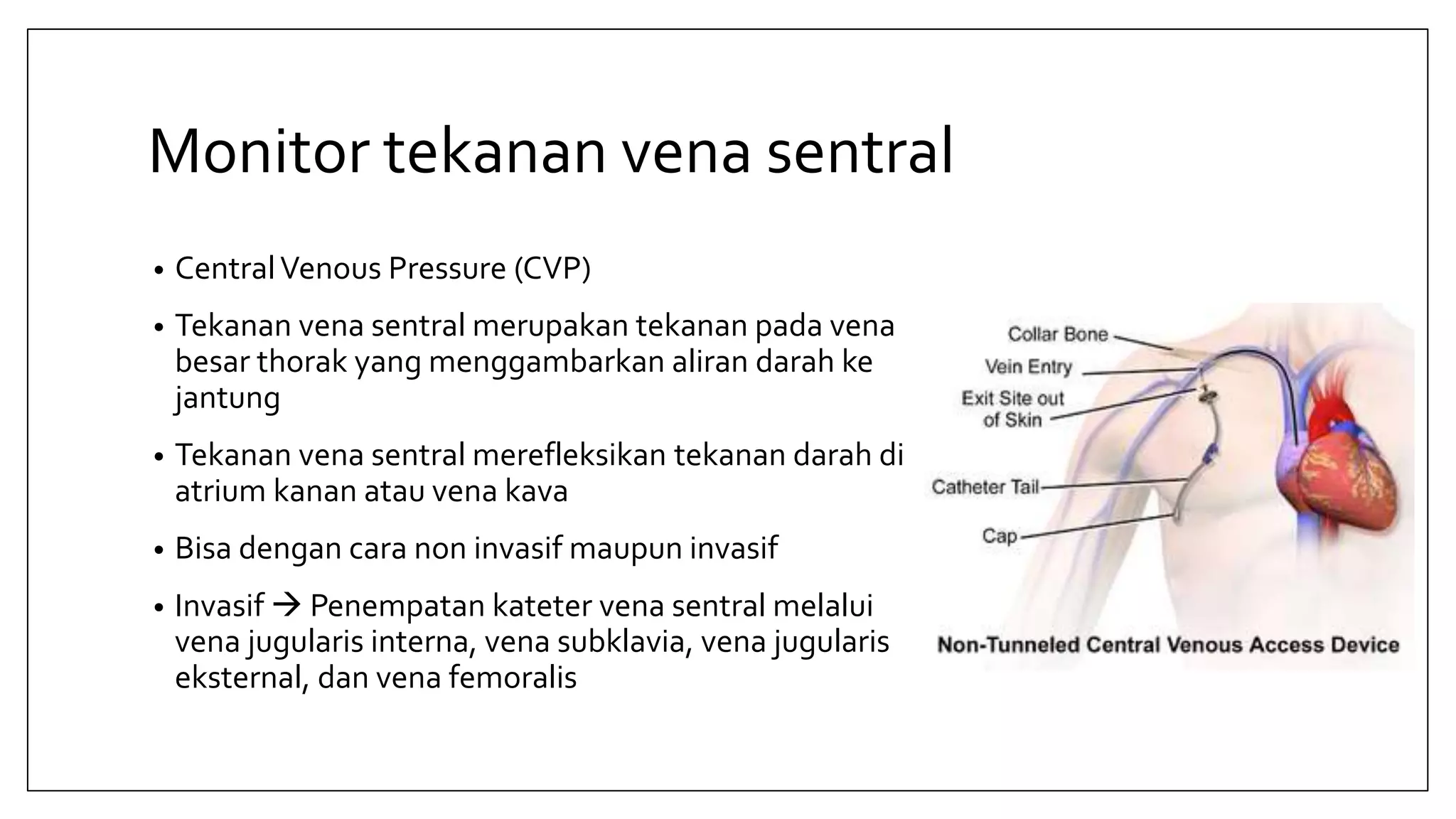 Pemantauan Status Hemodinamika.ppt