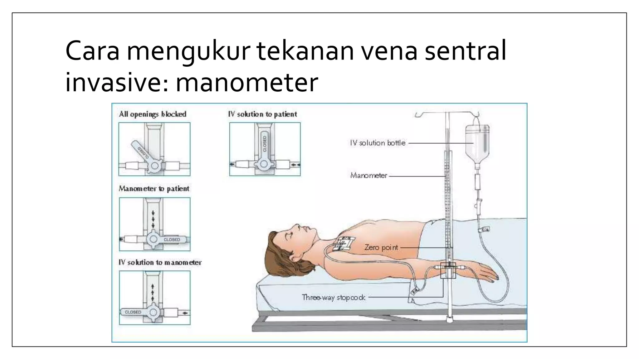 Pemantauan Status Hemodinamika.ppt