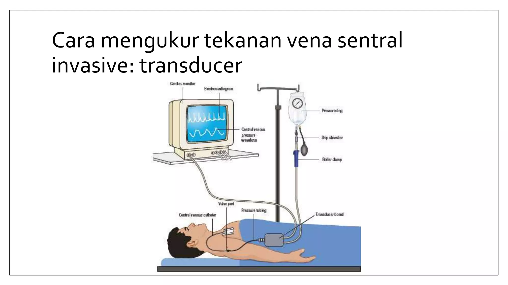 Pemantauan Status Hemodinamika.ppt