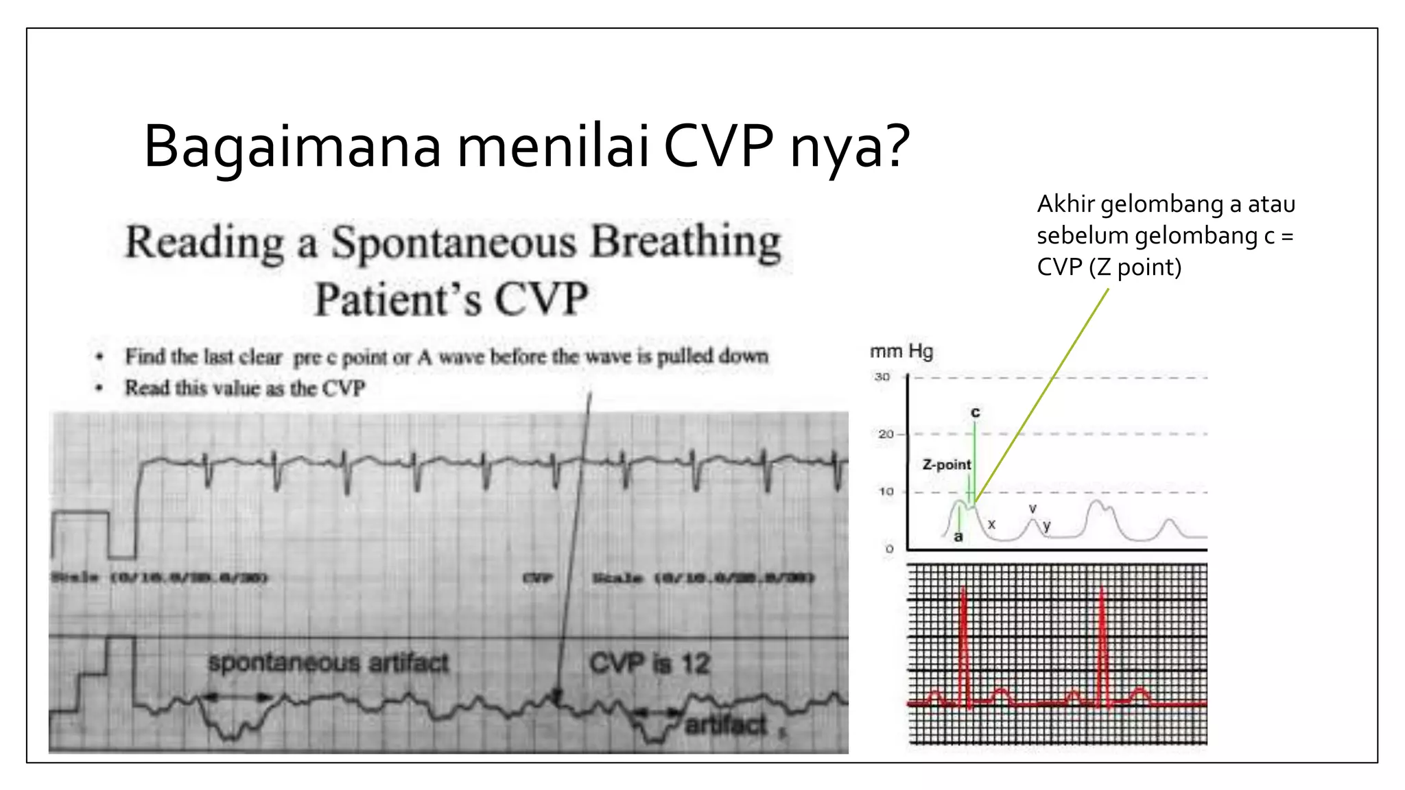 Pemantauan Status Hemodinamika.ppt