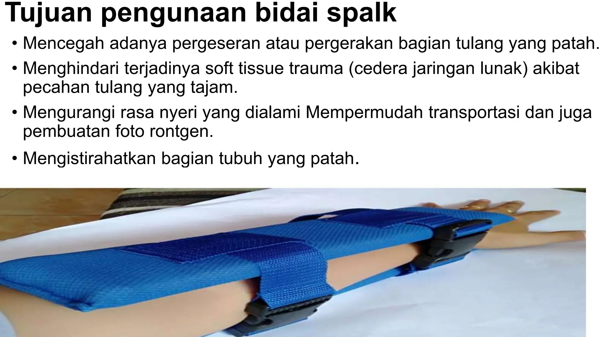 Pemasangan bidai spalk samuel yang sangat luarbiasa hebat dan susah.pptx