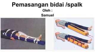 Pemasangan bidai spalk samuel yang sangat luarbiasa hebat dan susah.pptx