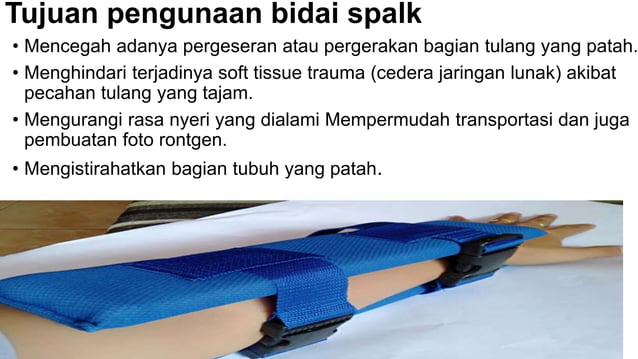 Pemasangan bidai spalk samuel yang sangat luarbiasa hebat dan susah.pptx