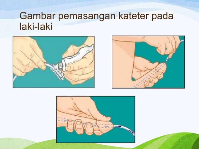 Pemasangan kateter | PPTX