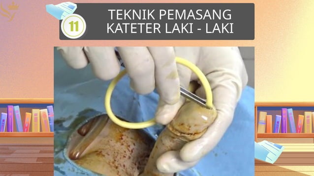 Cara Pemasangan Kateter yang baik dan benar | PPTX
