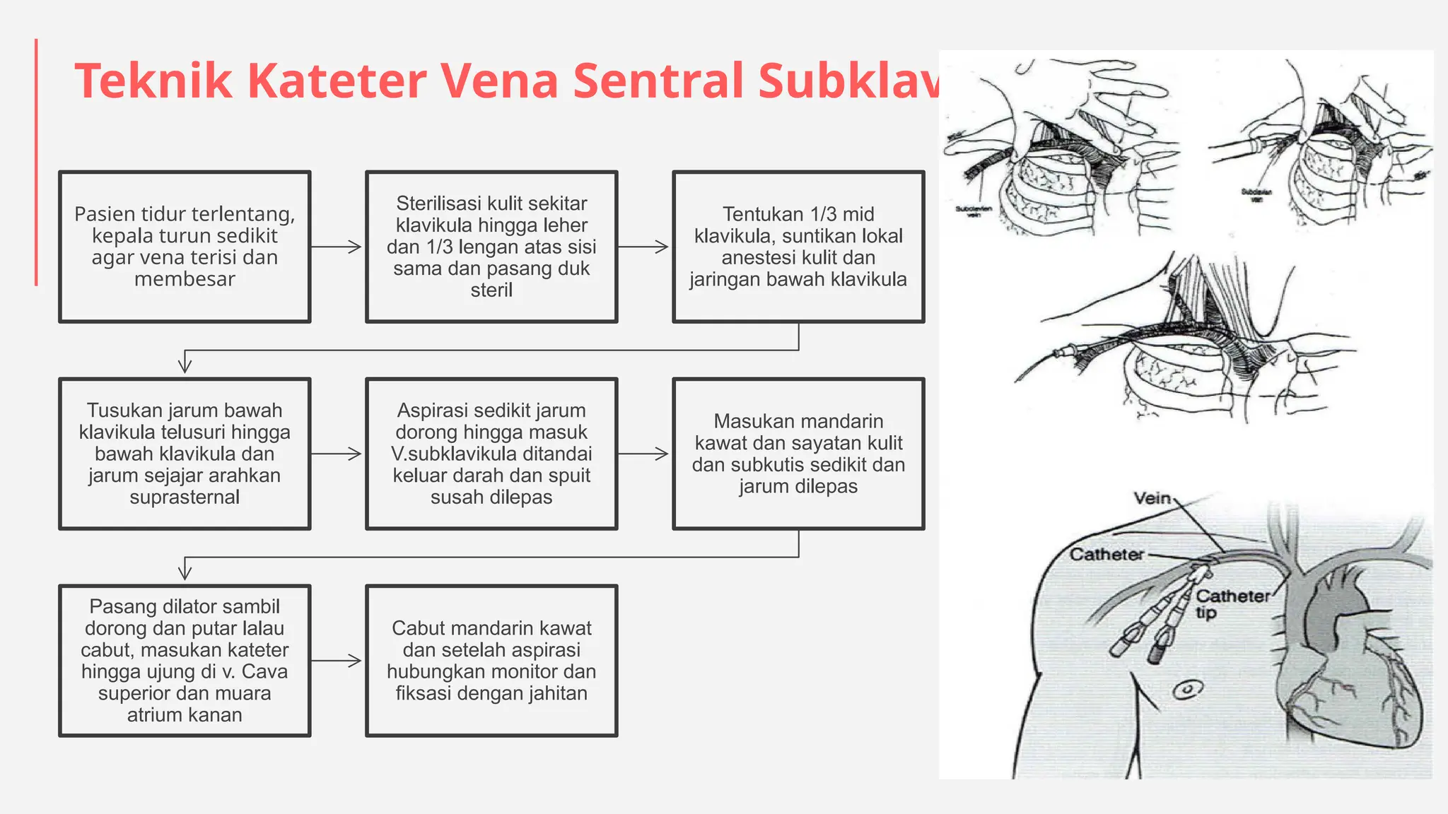 pemasangan monitoring Hemodinamik Invasif | PPTX